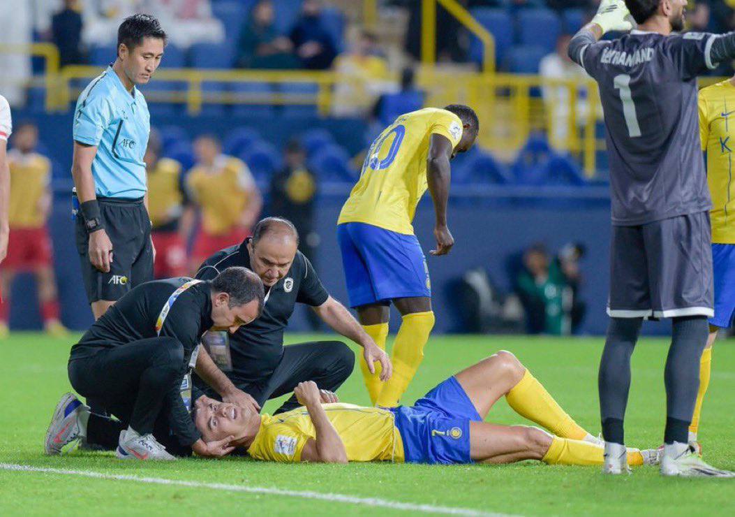 النصر يكشف مدى خطورة إصابة كريستيانو رونالدو قبل مواجهة الهلال - بالجول